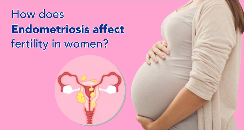 How Does Endometriosis Affect Fertility In Women Fortis Healthcare